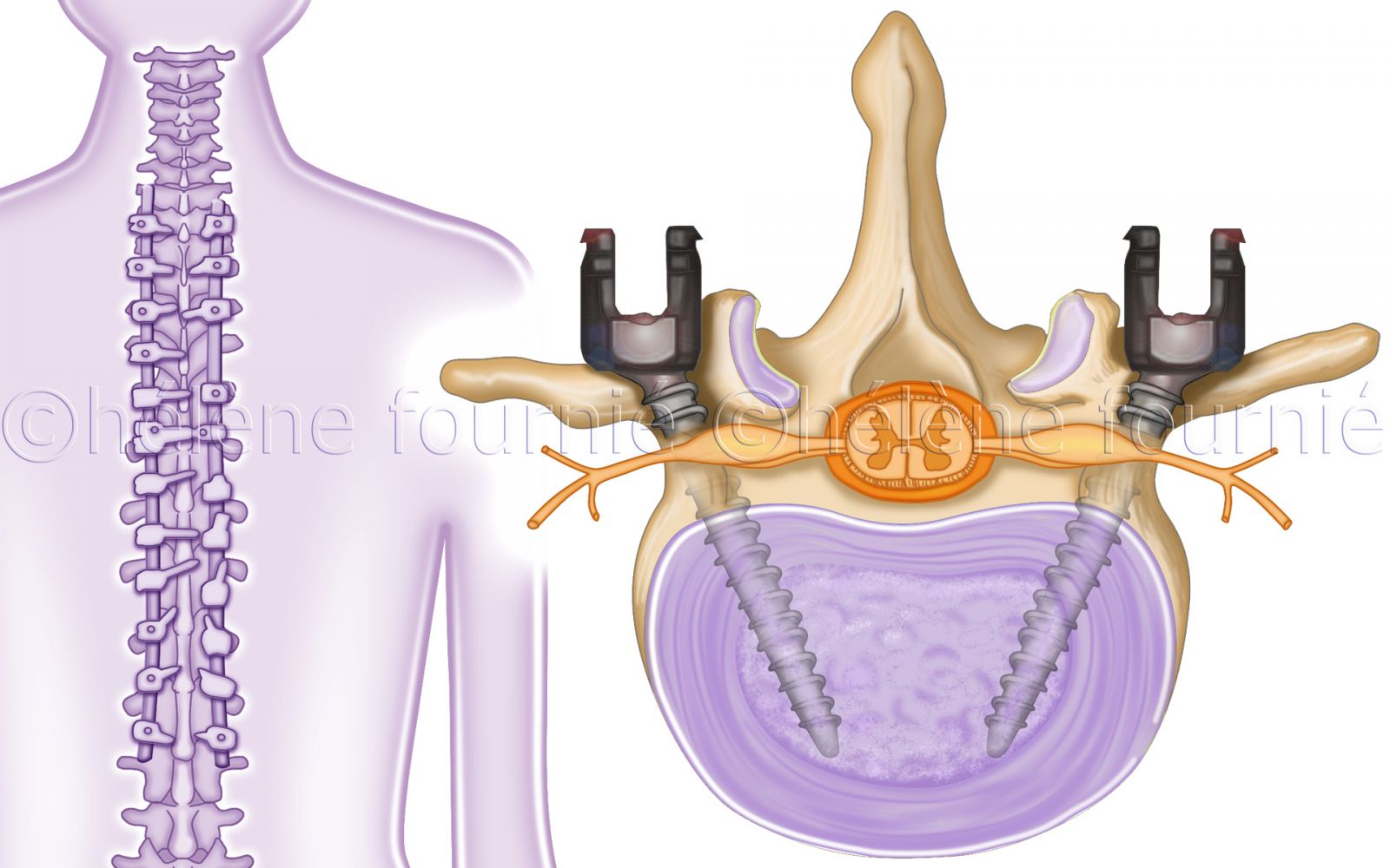 Medical - Illustration medicale et scientifique